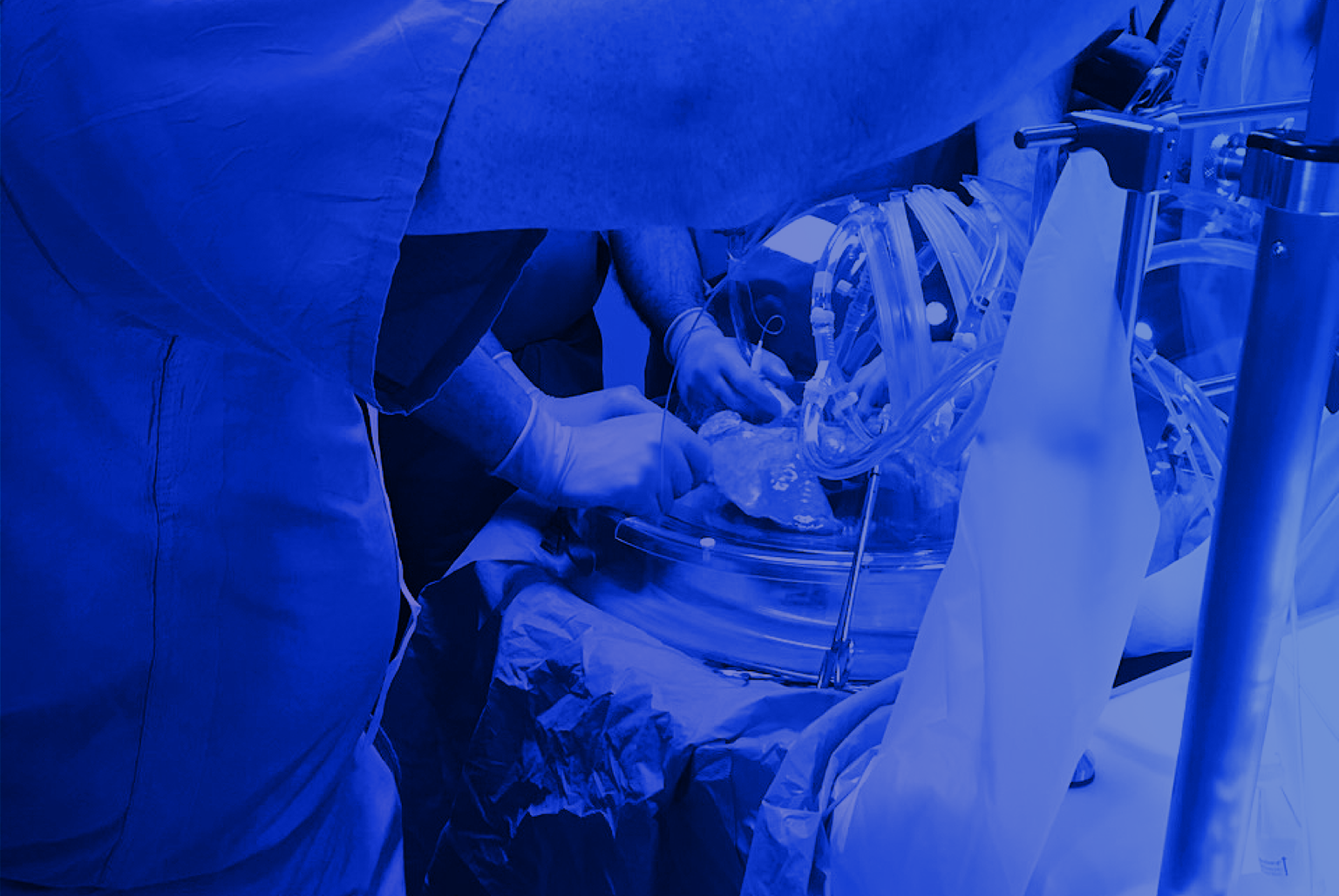 Mechanical Perfusion and Oxygenation for Extended Ex Vivo Organ ...